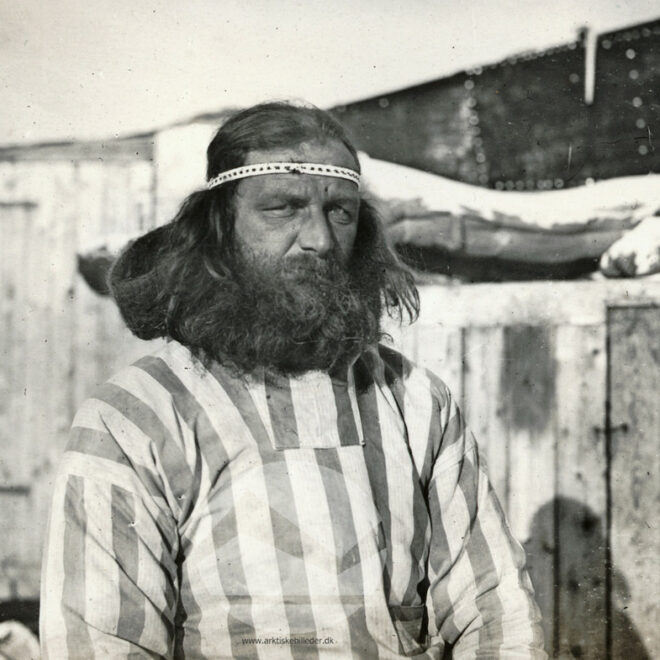 Essie Dunbar: The Woman Who Lived for Another 40 Years After Being ...