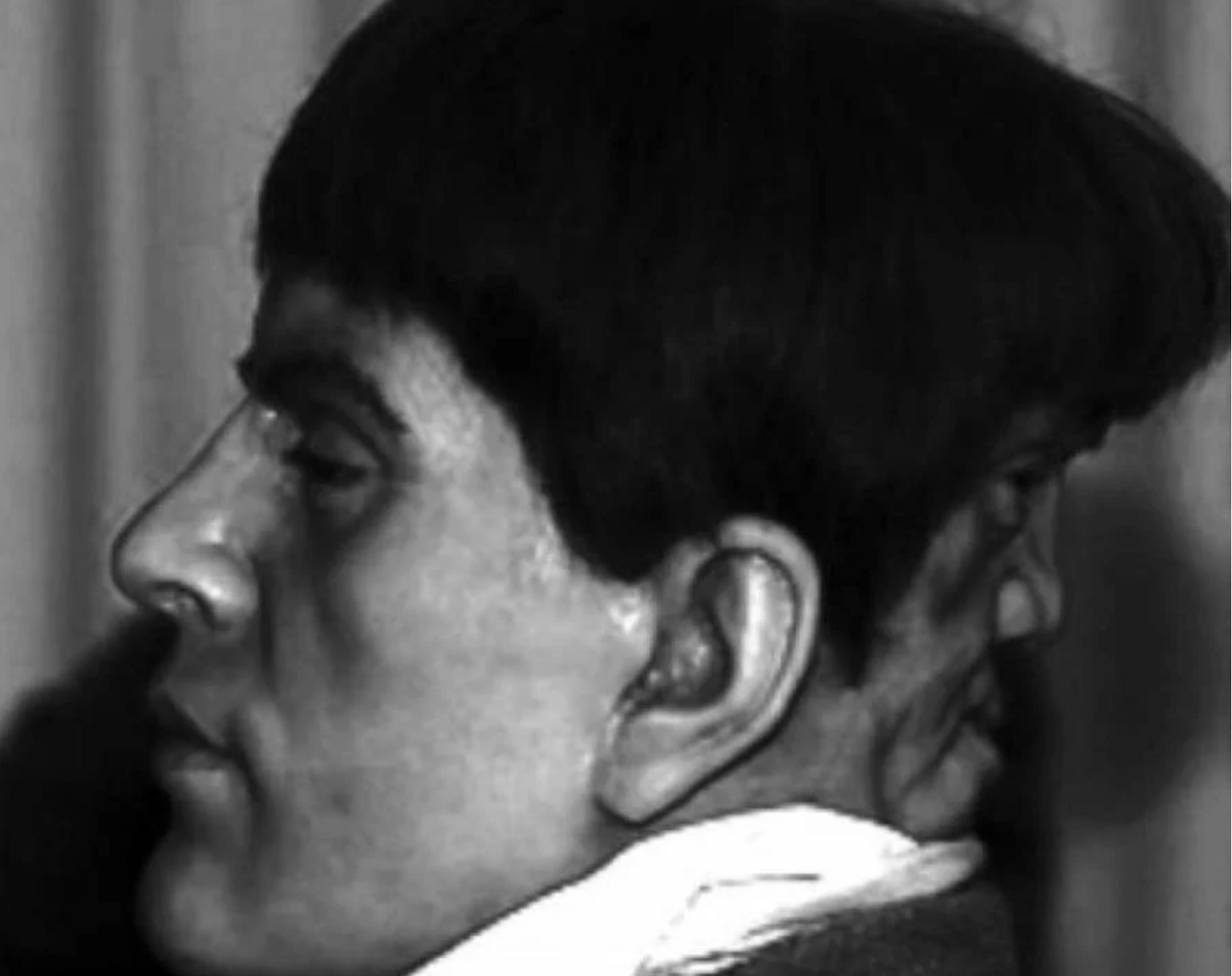 Real or a Hoax? The Legend of Edward Mordrake