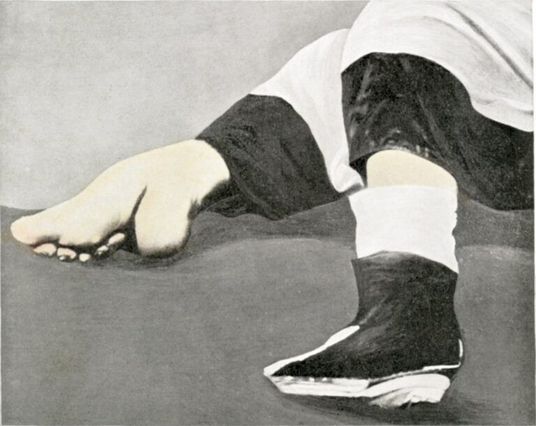 The Painful Legacy of the Tradition of Foot Binding