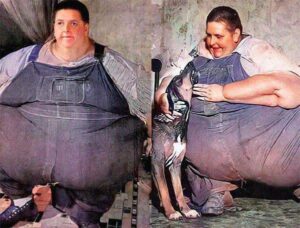 Jon Brower Minnoch: The heaviest man in history